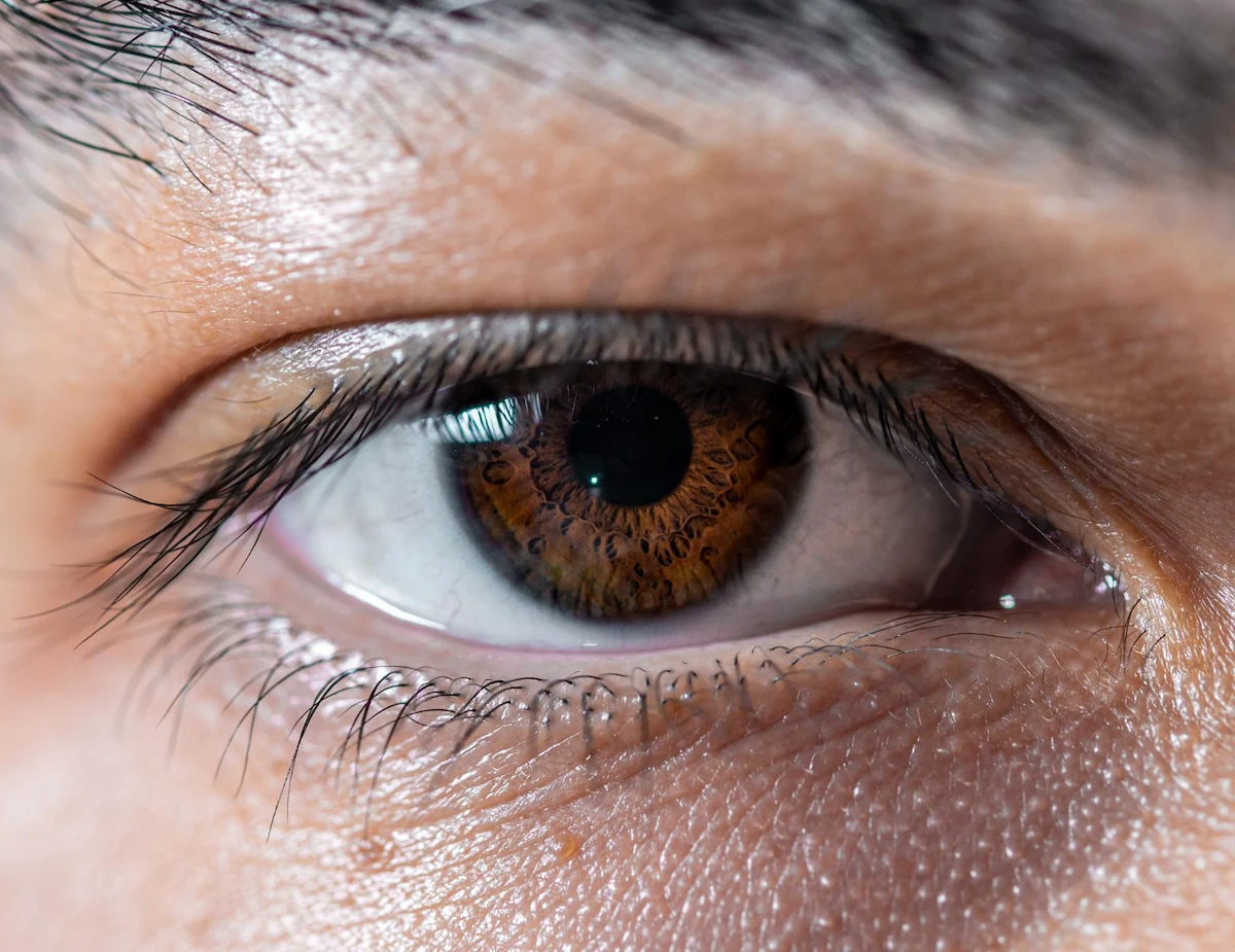 Apa Itu Iris Mata? Ini Fungsi & Gangguan yang Umum Terjadi - JEC Eye ...
