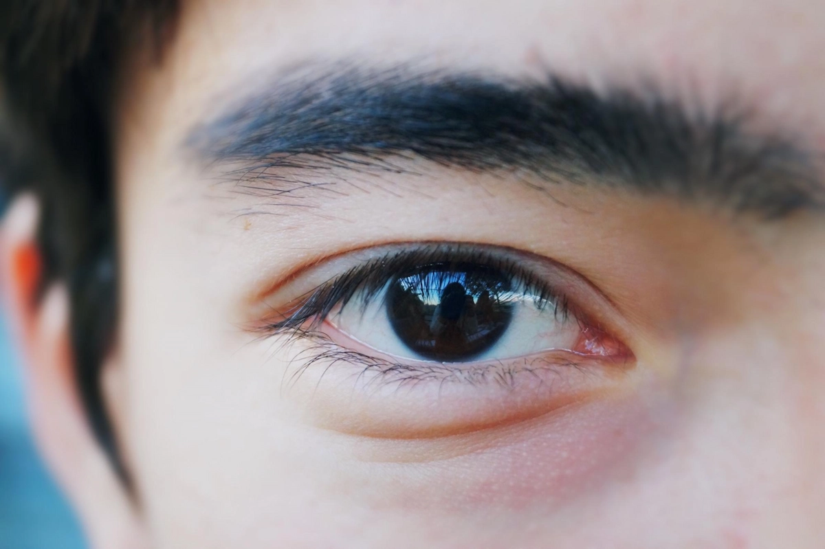 Ketahui Fungsi Pupil pada Mata beserta Gangguannya - JEC Eye Hospitals ...