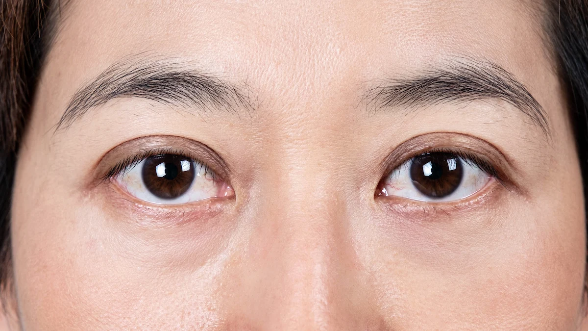 Sindrom Horner (Horner Syndrome): Penyebab, Gejala, dan Pengobatannya ...